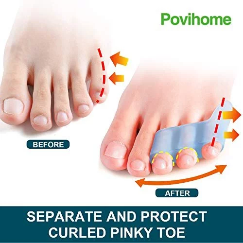 Povihome 10 Pack Pinky Toe Separator and Protectors, Toe Separators for ...