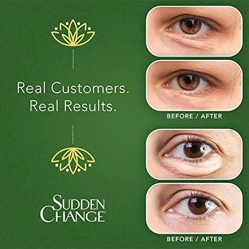 Sudden Change Instant Under Eye Firming Serum New Formula Under Eye Bags Treatment For Puffiness Lines Wrinkles Wear With Or Without Makeup Imported Products from USA iBhejo